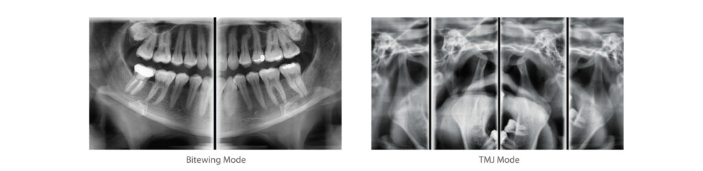 Vatech PaX-i Plus 2D - DRCNZ - Dental X-ray Supplier